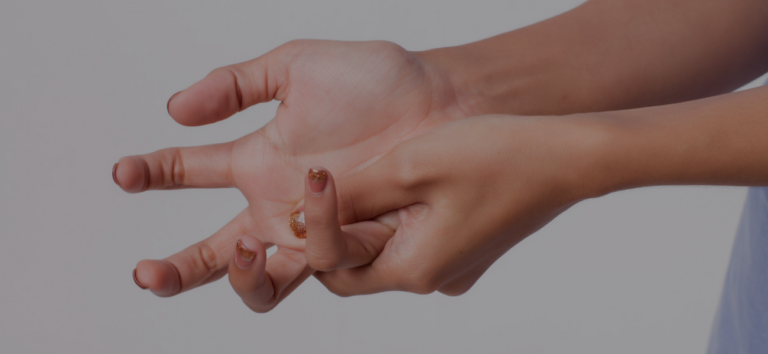 Trigger Finger Physical Therapy | OrthoRehab Specialists - Edina, MN